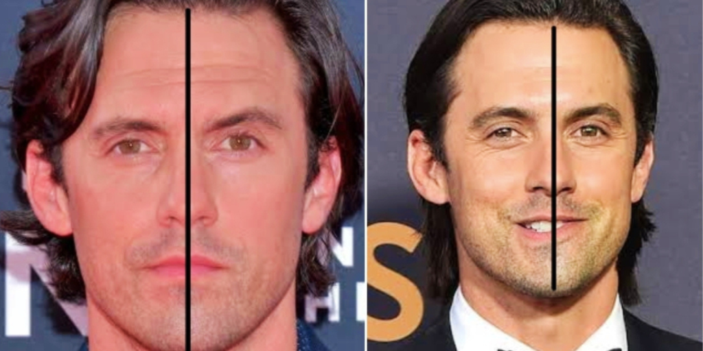 10 Celebrities With Asymmetrical Faces - TVovermind