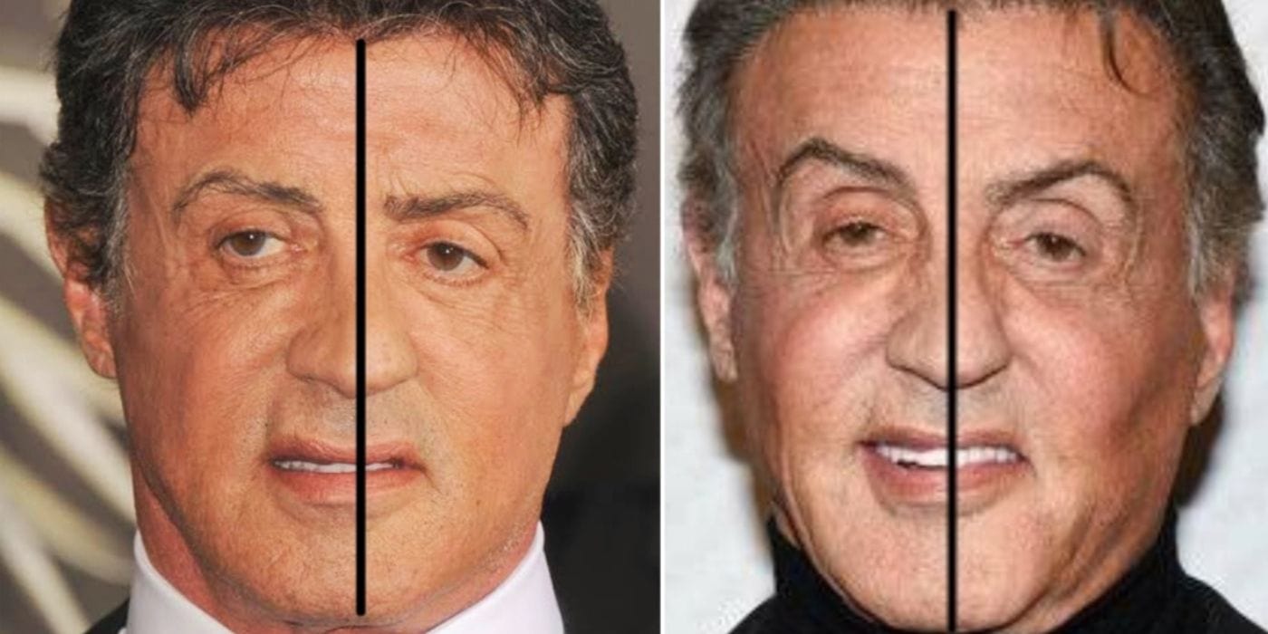 10 Celebrities With Asymmetrical Faces - TVovermind